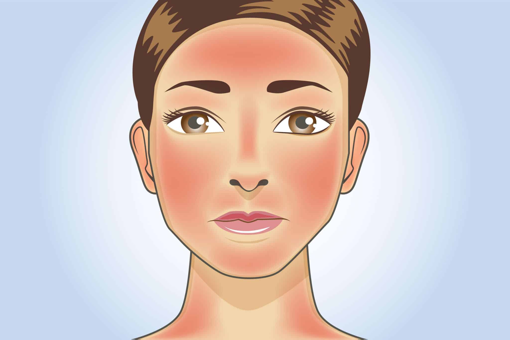 How to Prevent Red Face When Drinking